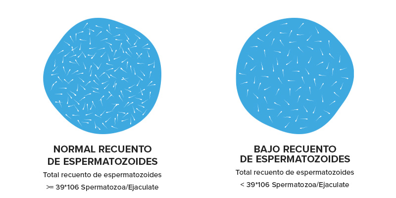 Ilustración De La Diferencia Entre Un Recuento De Espermatozoides